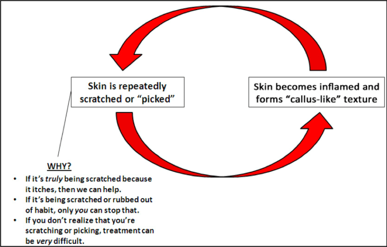 Prurigo Nodularis and LSC - Pennsylvania Dermatology Specialists